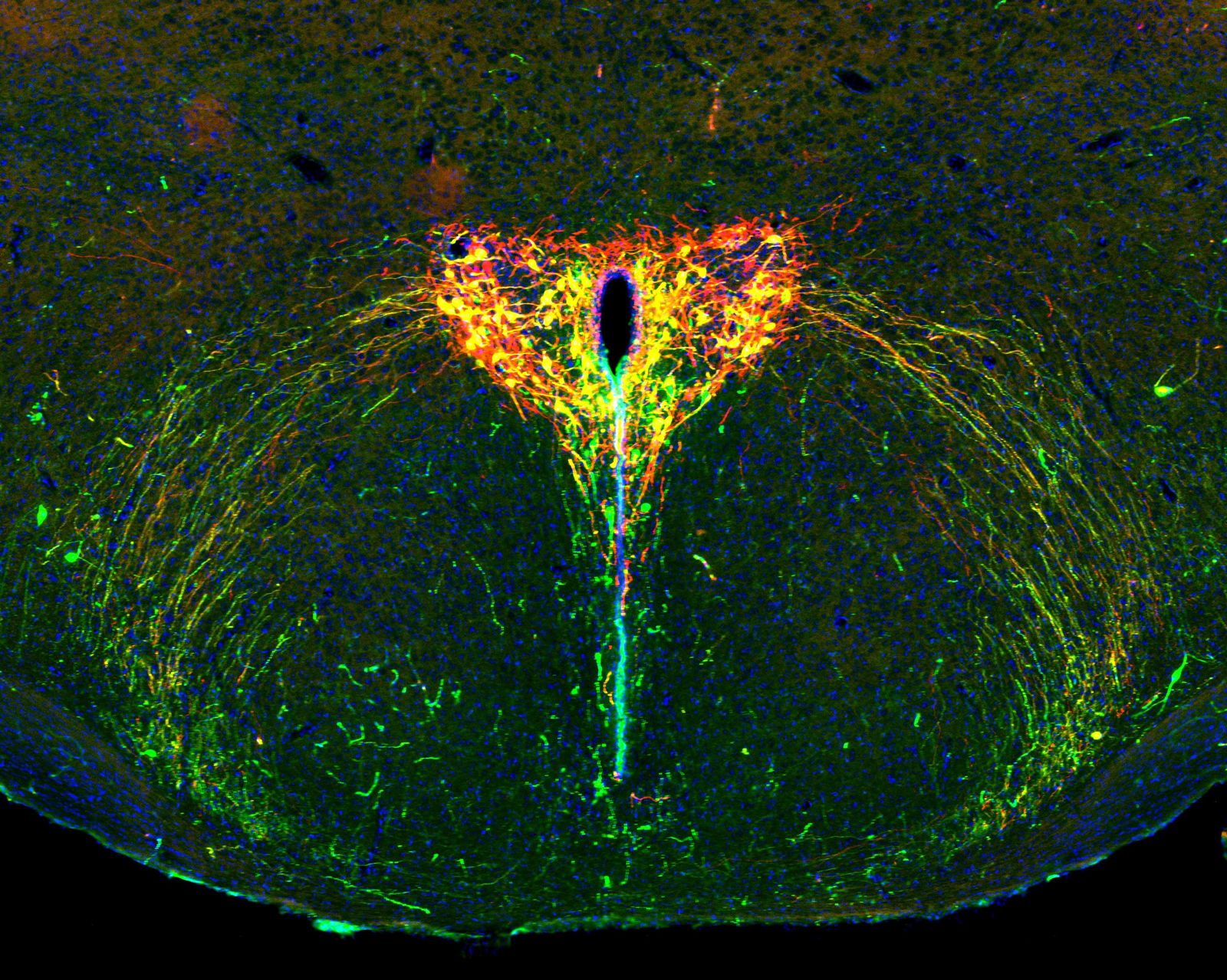 Shining a Light on the Developing Brain: How Parental Separation Shapes ...